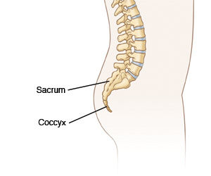 Coccygodynia