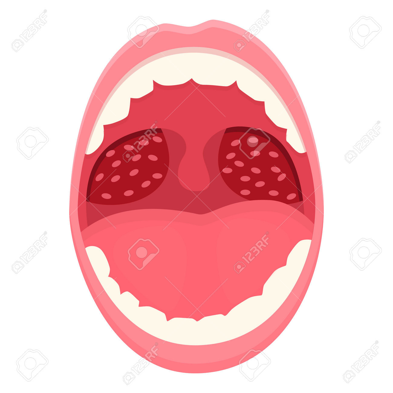 ORAL CANCER