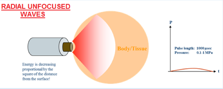 The “Shock”-ing Truth about Pressure Waves