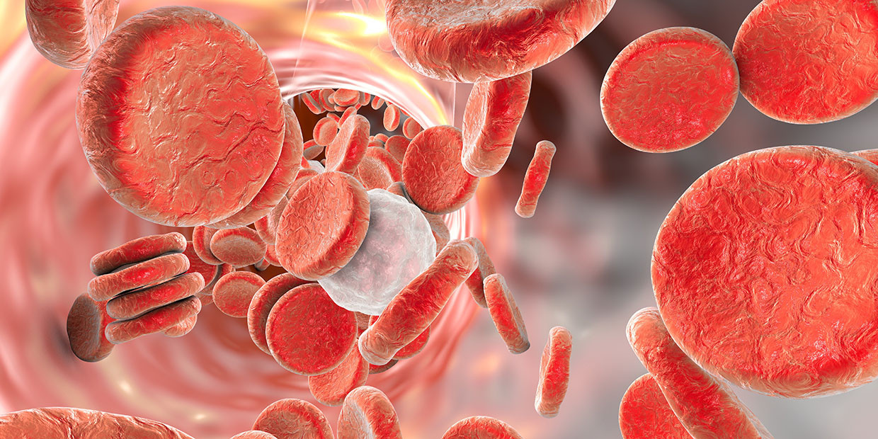 Plaquex Infusion Therapy | METALAB