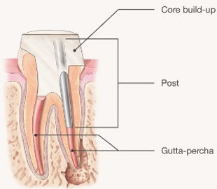 Endodontic Associates of Clear Lake | patient-centered endodontic care ...