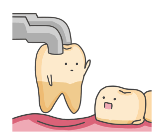 Wisdom Tooth Removal: What to Expect Before & After Surgery | Dr. Kurt ...