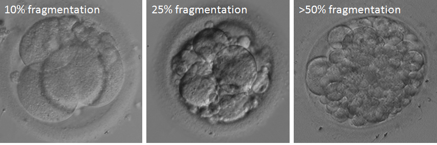 Embryo Grading (guest post from Embryoman)
