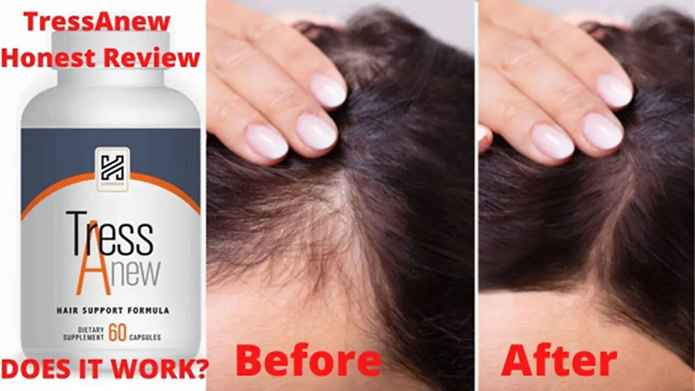 "Unlocking the Secrets to Stronger, Healthier Hair with Tress Anew":The ...