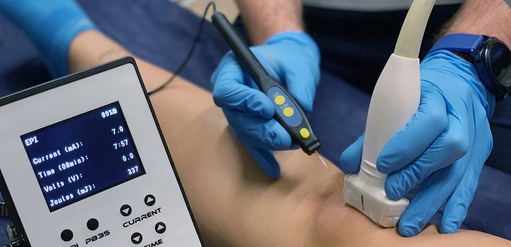 Evidenze scientifiche a supporto della tecnica EPI