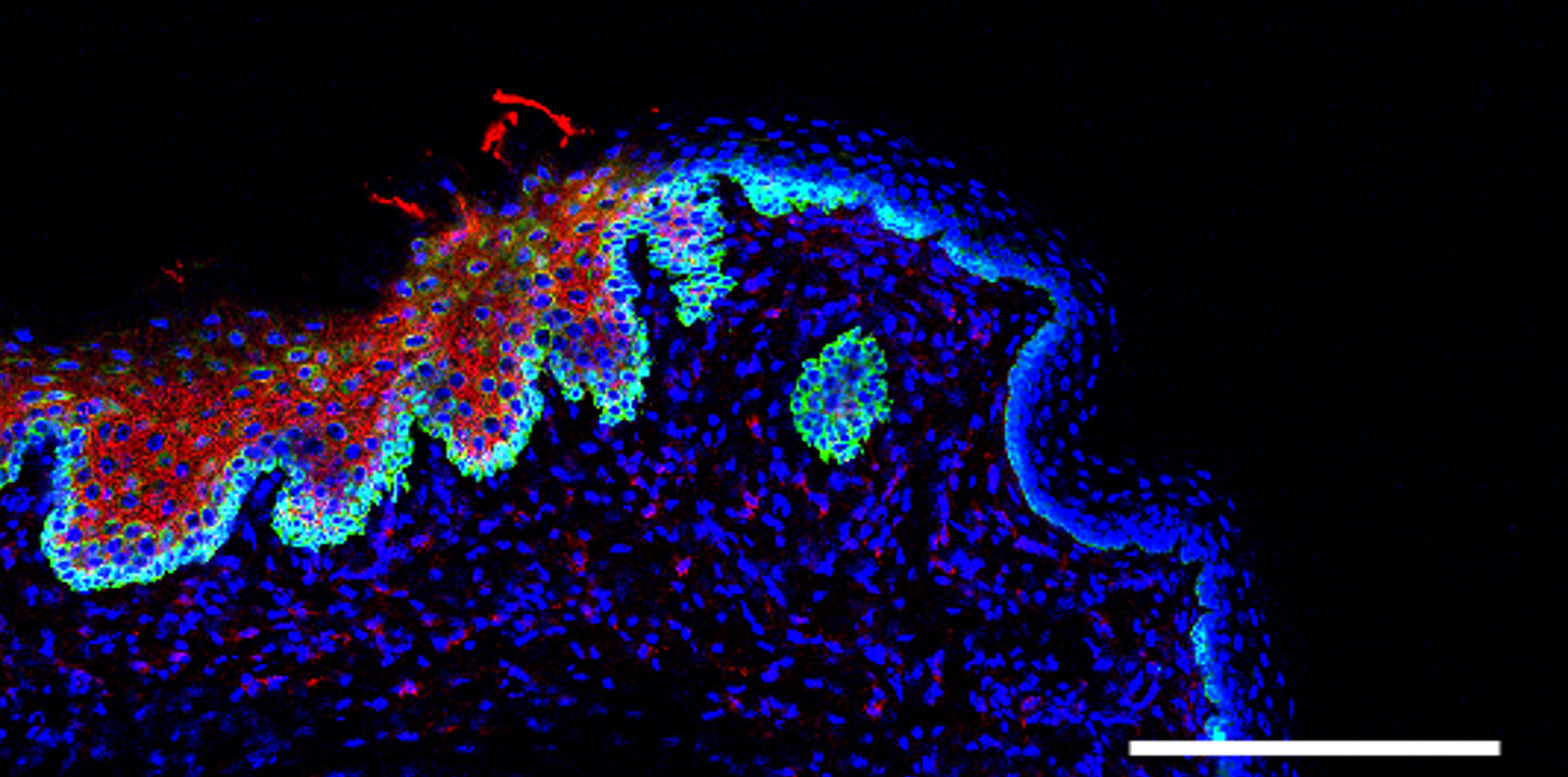 Watt Lab | Research Image | Mouse Upper Lip