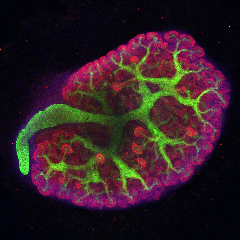Watt Lab | Research Image | Developing mouse kidney