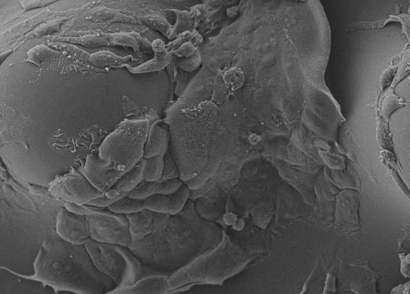 Watt Lab | Research Image | Differentiated and underdifferentiated ...