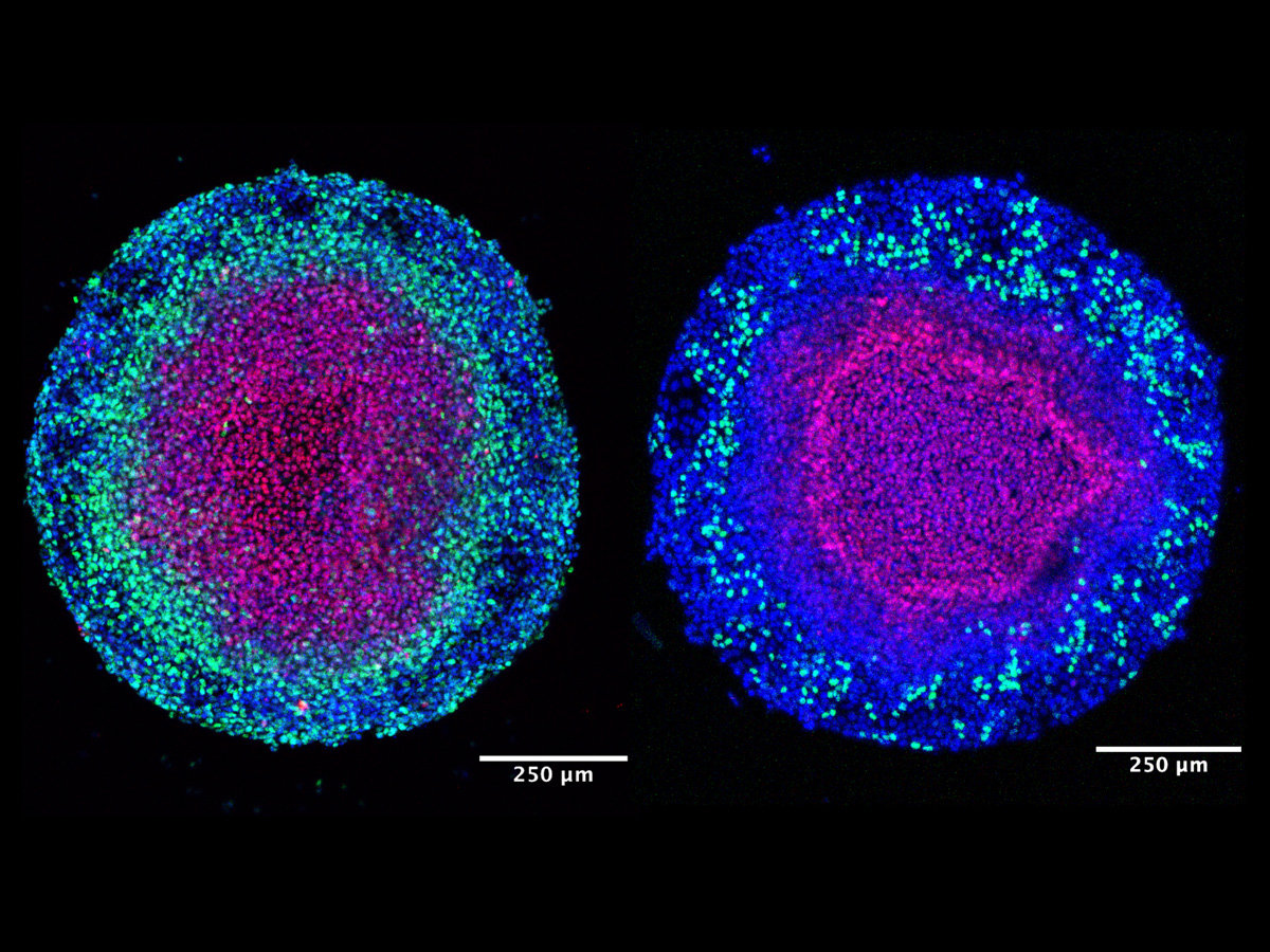 Watt Lab | Research Image | Differentiation of iPSCs