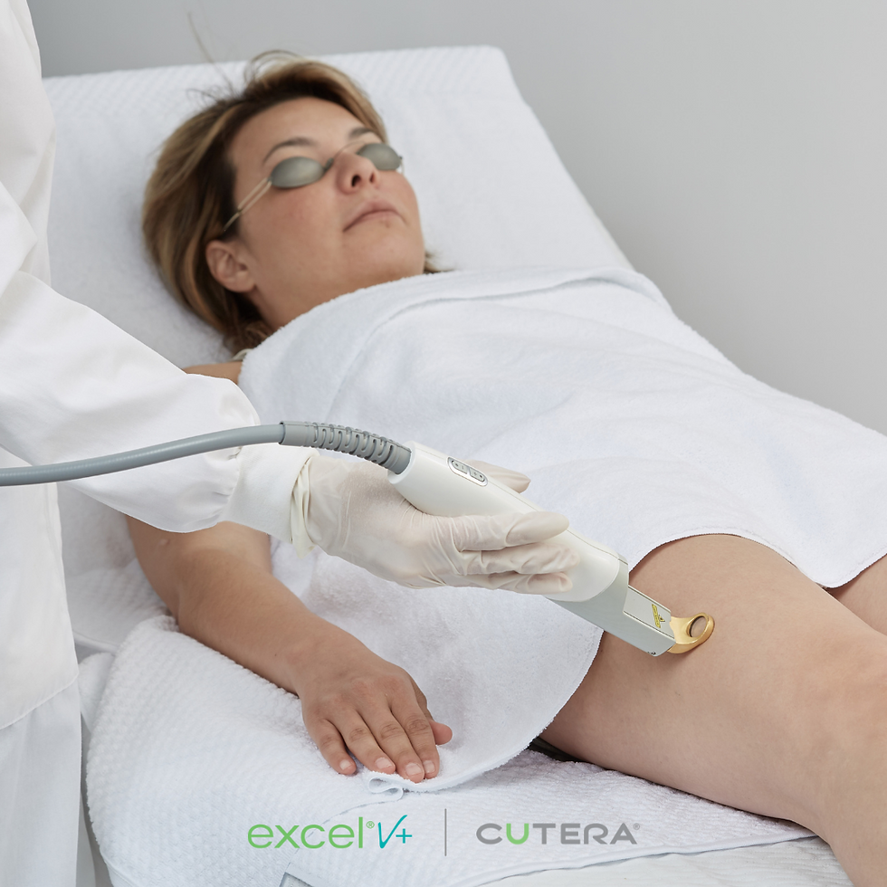 Introducing Excel V+ Laser: Elevating Aesthetic Possibilities at ...
