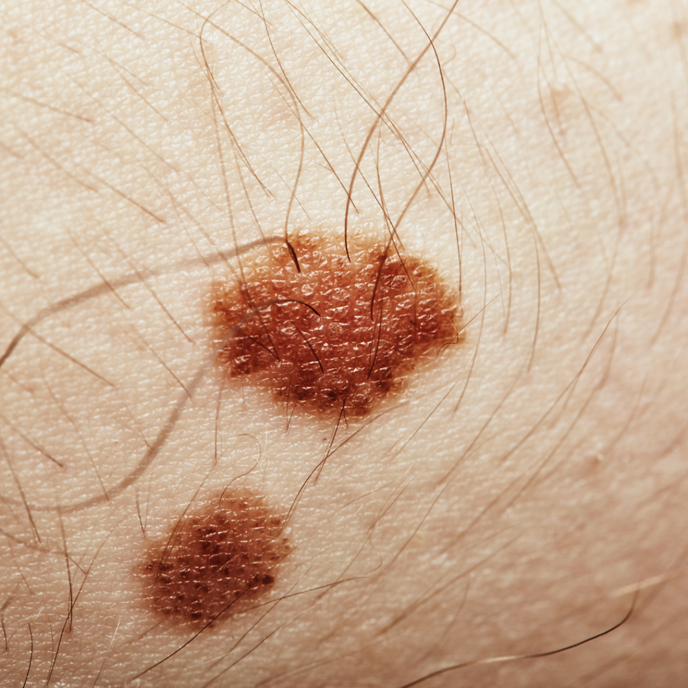 Scientists believe they've discovered a cure for baldness. It's hiding ...