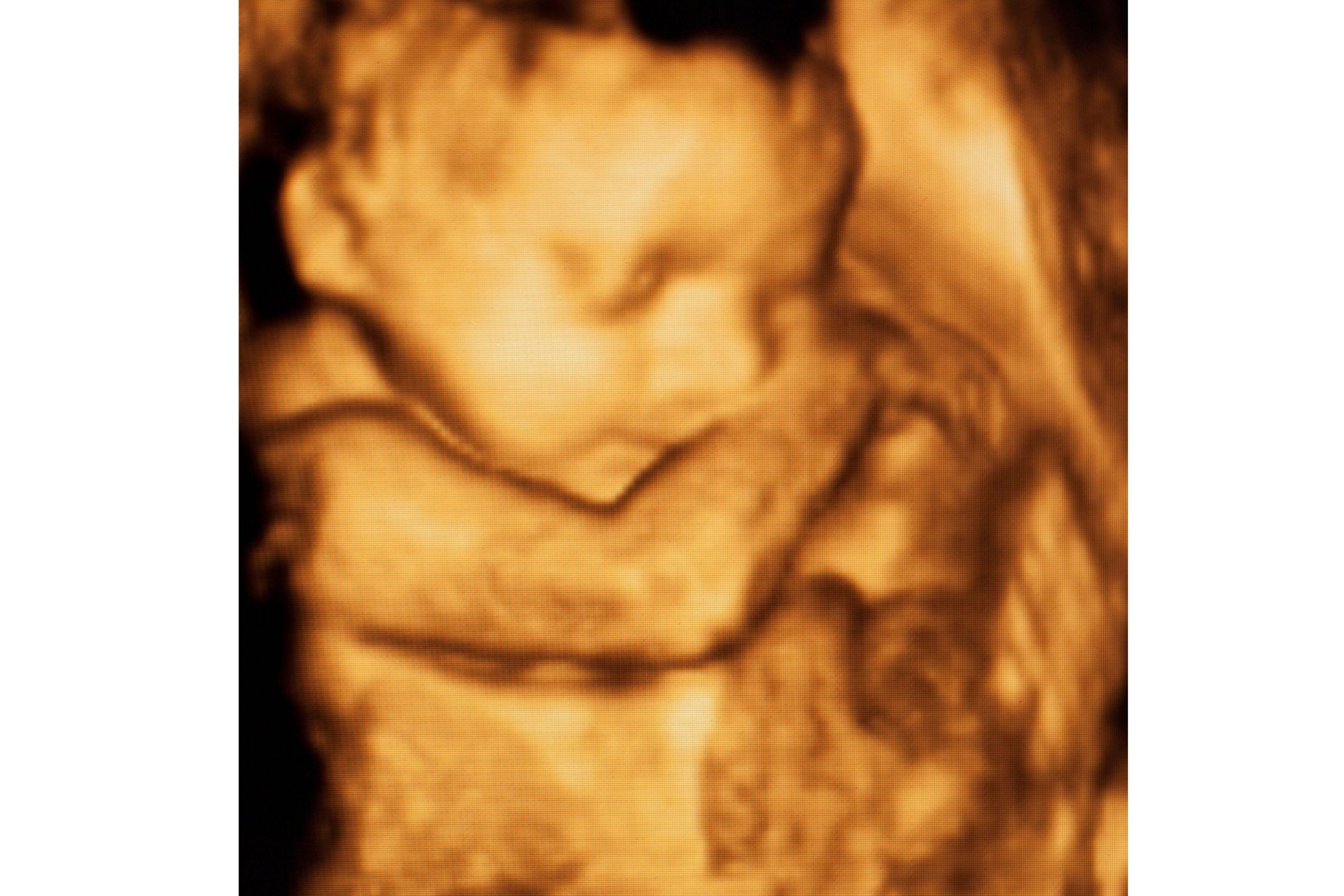 When Do Babies Start Smiling? Understanding Your Baby's Smiles