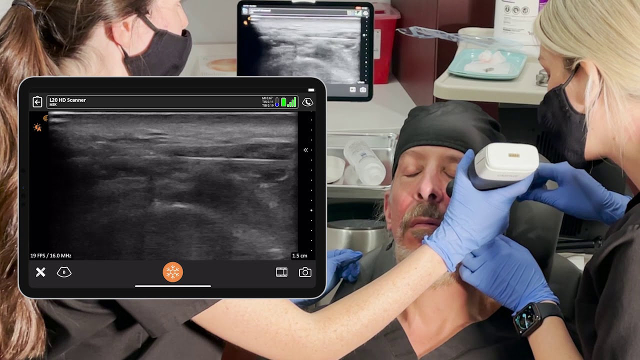 Facial Ultrasound-Guided Assessment | Rejuvenus Clinic