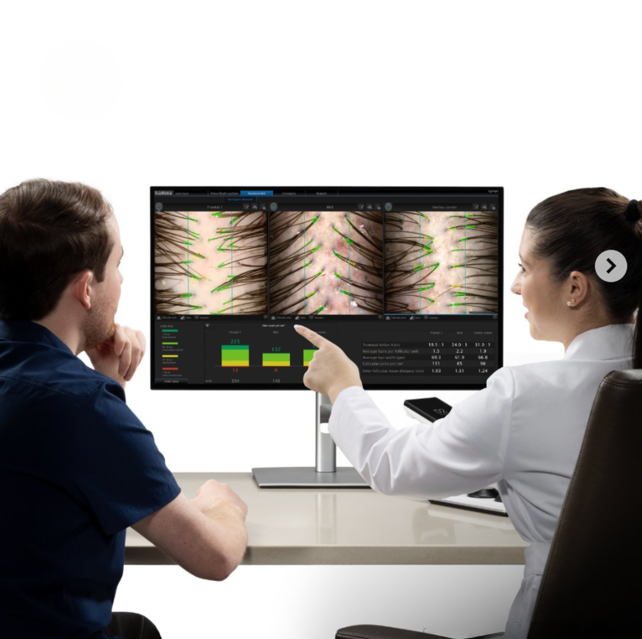 Hair Loss Assessment | Scalp Analysis | Rejuvenus Clinic