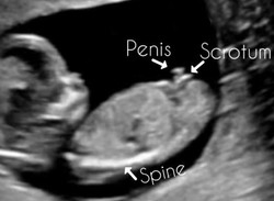 Ultrasound Nub Theory UK | The Nub Techs