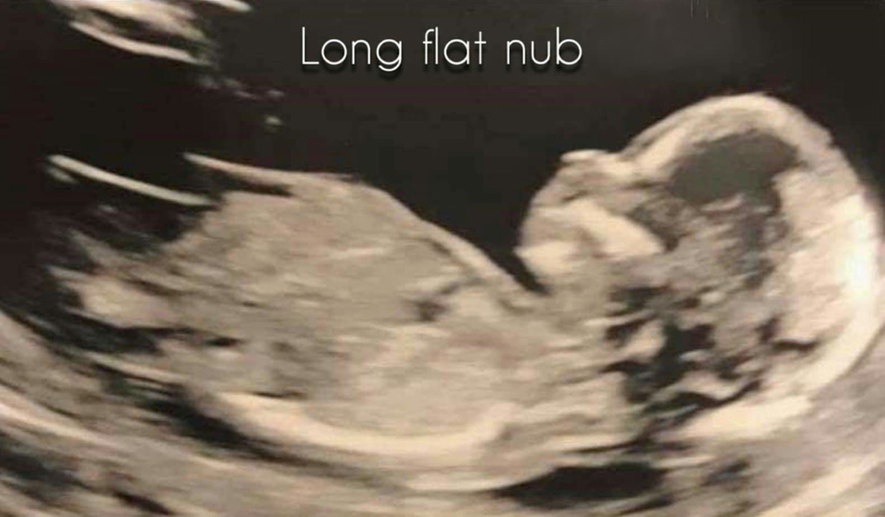 Nub Theory Girl Nub
