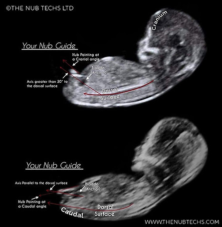 The Nub Theory Explained | The Nub Techs