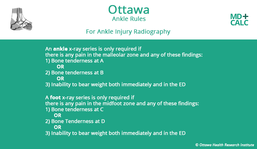 Ottawa Ankle Rules