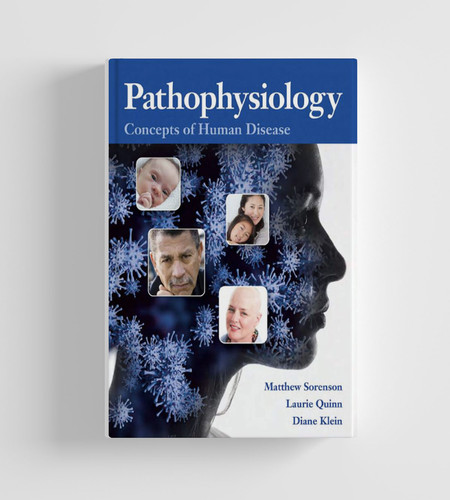 Pathophysiology: Concepts of Human Disease 9780134874340 | eTextbook4u