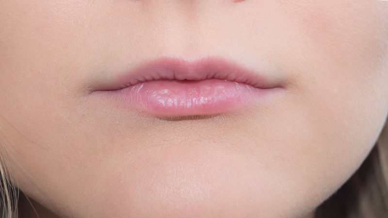 Thin Lips Causes and Treatments