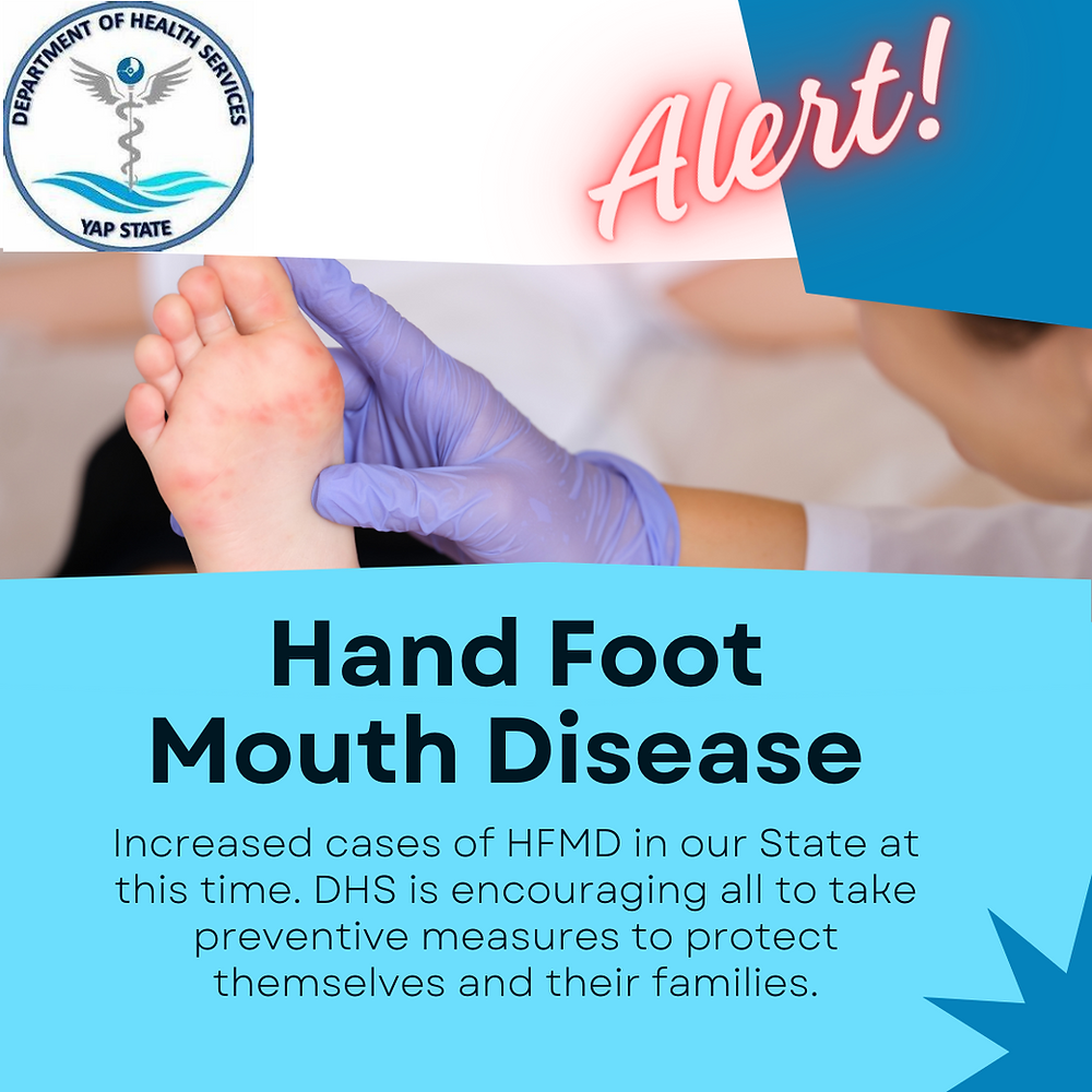 Alert from DHS on HFMD