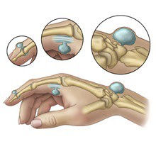 Common Finger Injuries from Rock Climbing