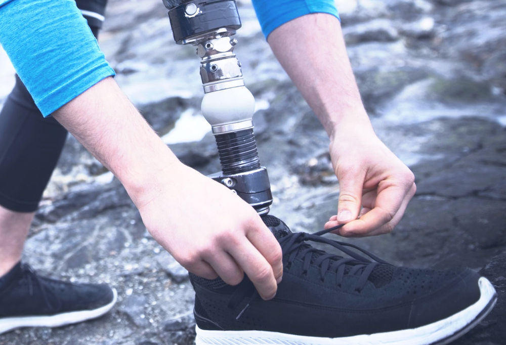 Prosthetic Feet - An Overview