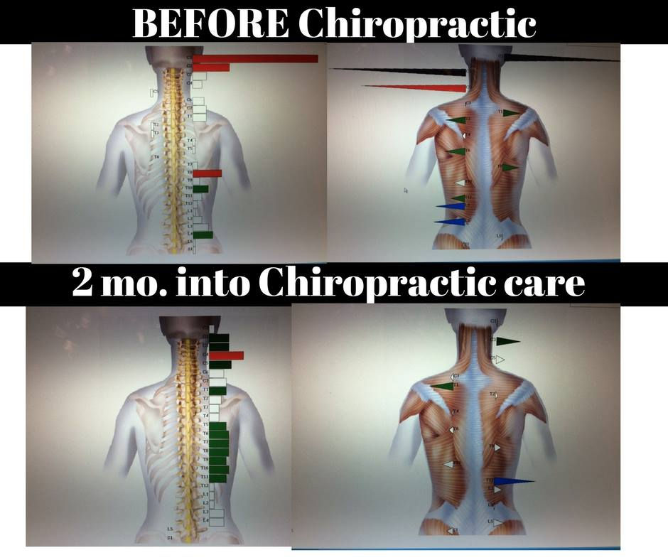 Understanding the Incredible Value of Principled Chiropractic