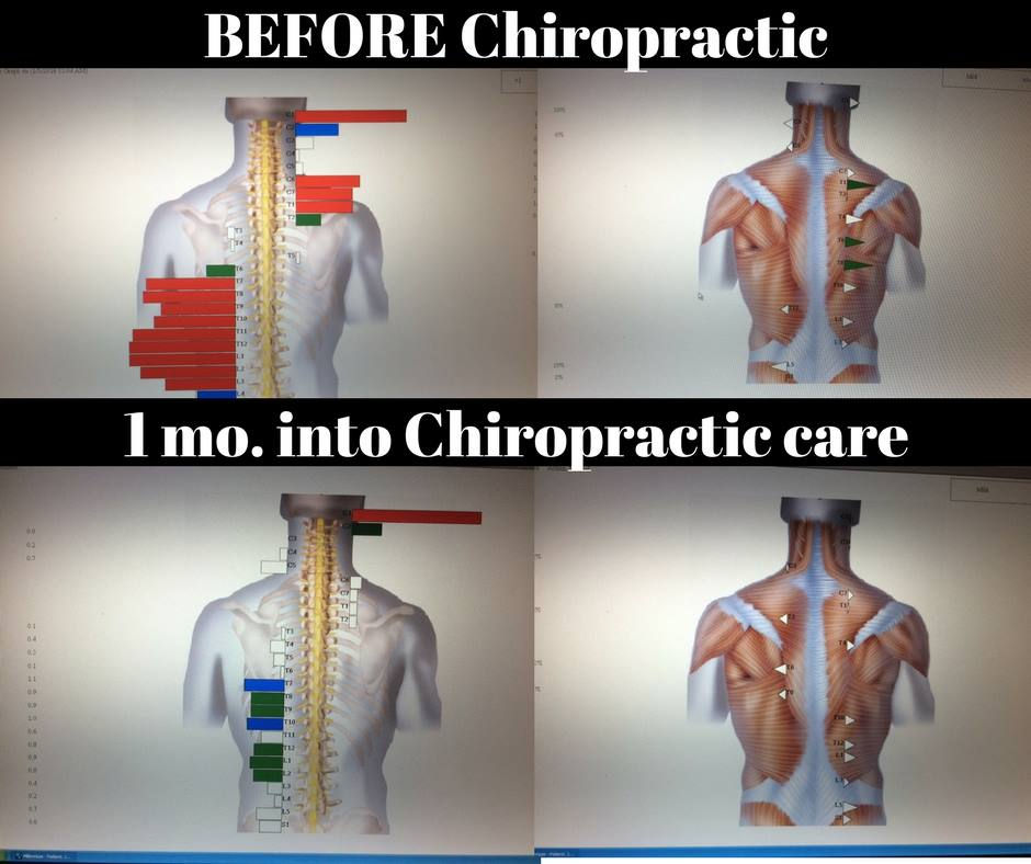 Understanding the Incredible Value of Principled Chiropractic