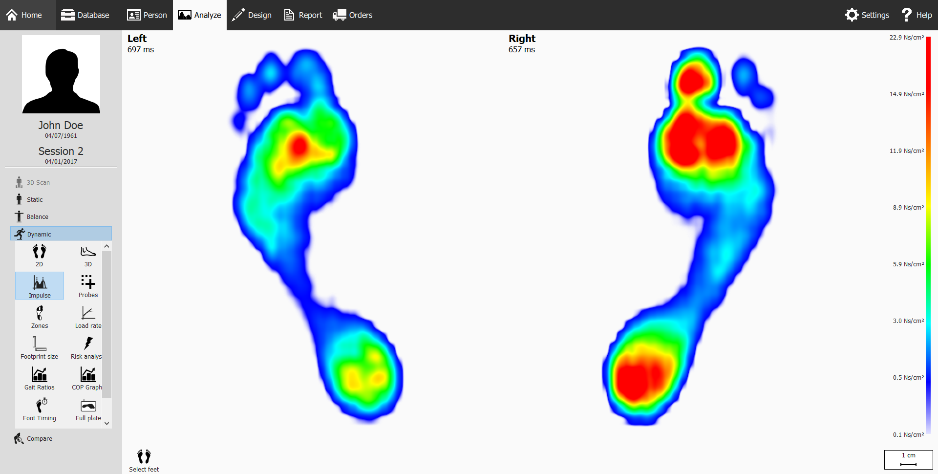 Footscan | Gait and Motion Technology