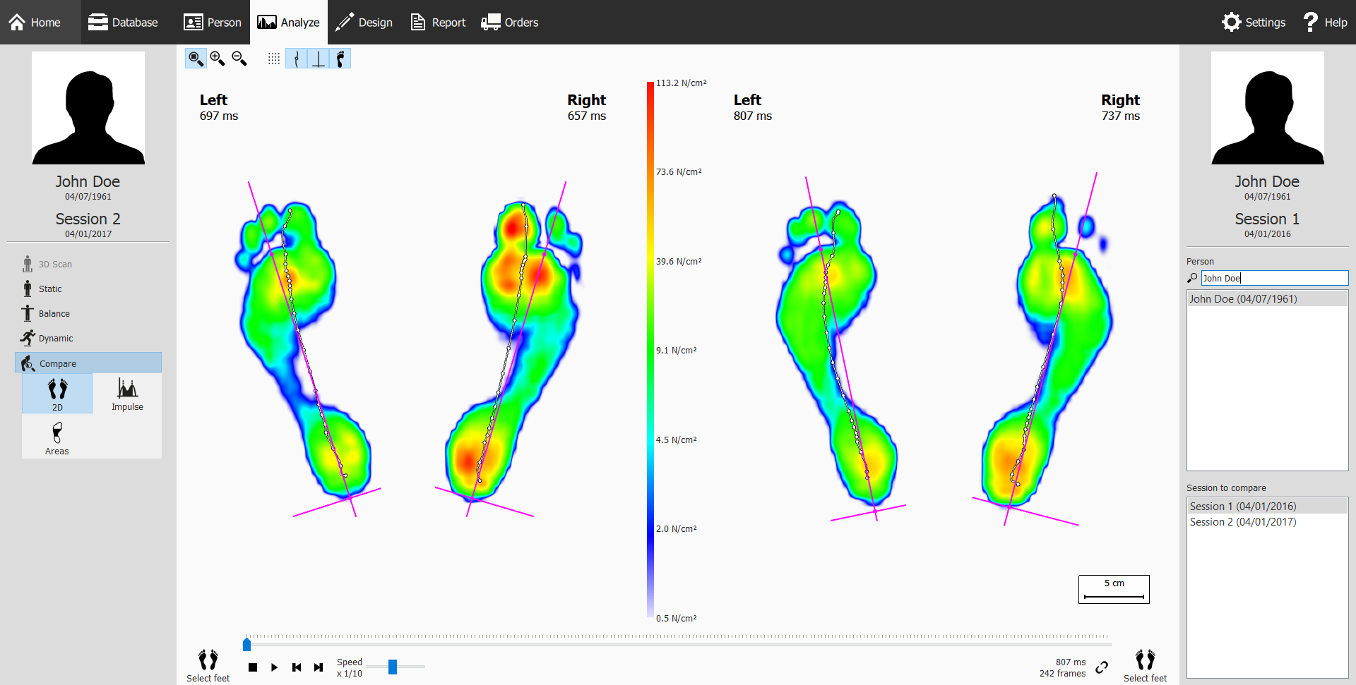 Footscan | Gait and Motion Technology