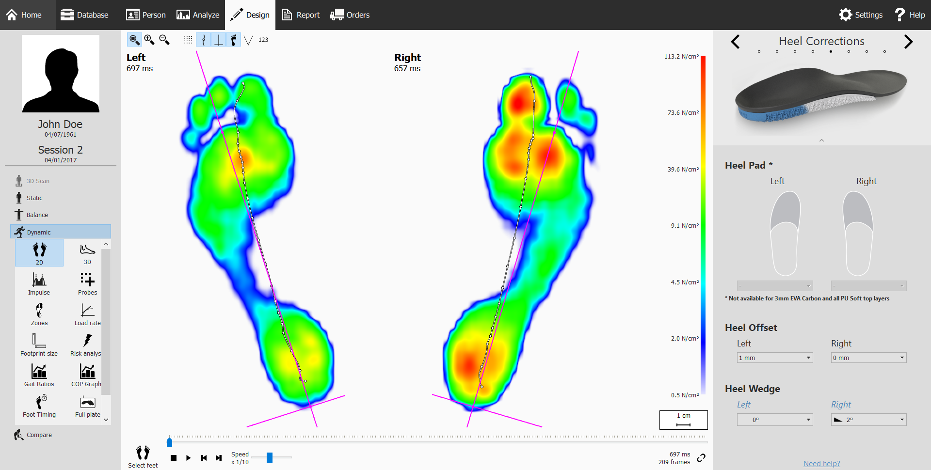Footscan | Gait and Motion Technology