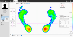 Footscan | Gait and Motion Technology