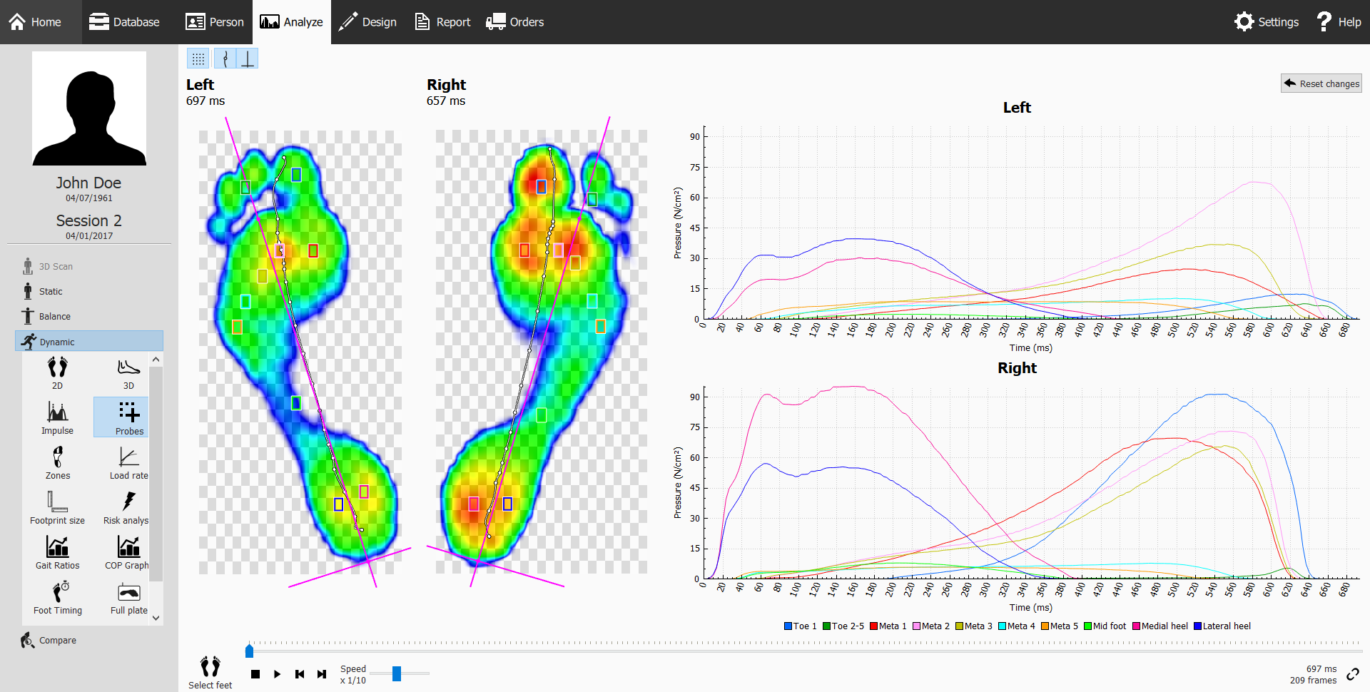 Footscan | Gait and Motion Technology