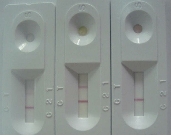 Kubadilika kwa majibu ya kipimo cha UKIMWI | ULY CLINIC