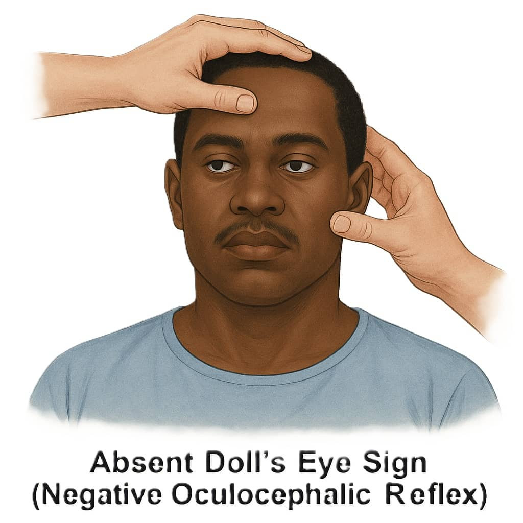 Absent Doll’s Eye Sign| ULY CLINIC