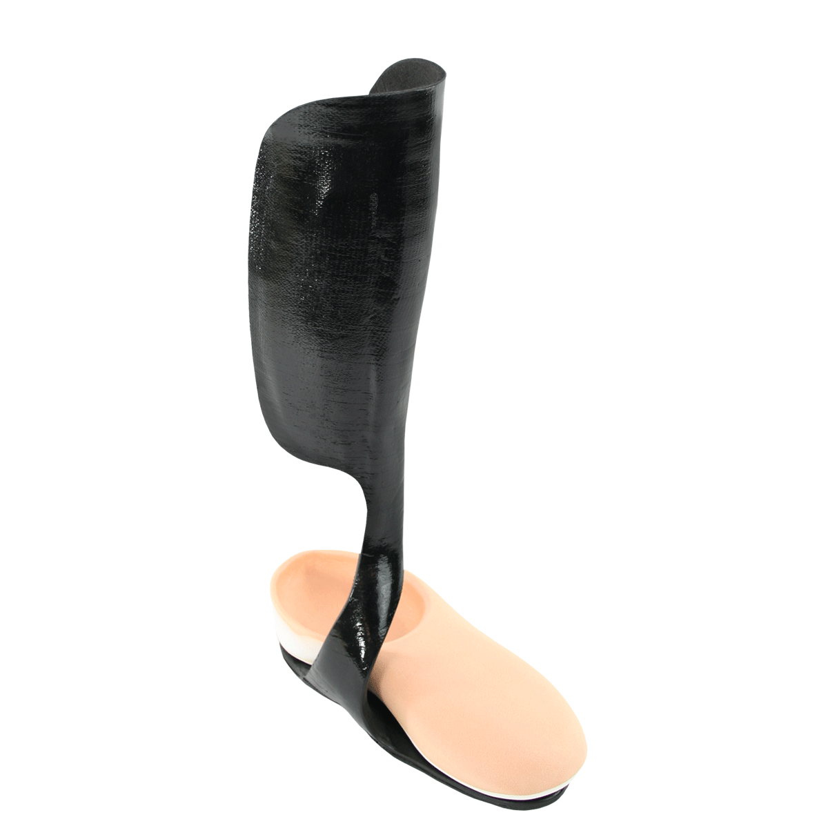Partial Foot Amputations and Prosthetic Solutions