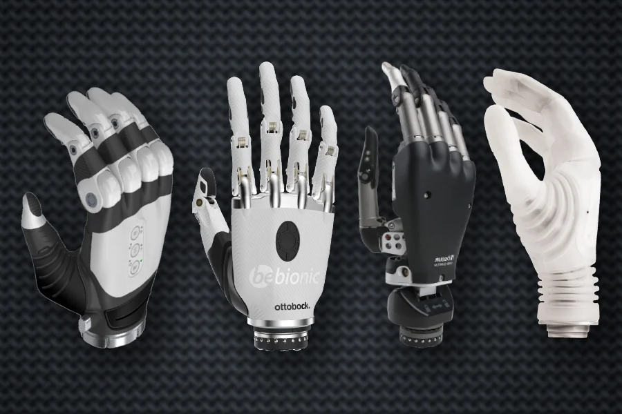 Multi-Articulating Myoelectric Hands | Northern Prosthetics