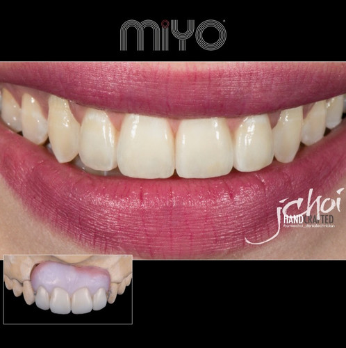 From Green State to | GlobalDentalGallery