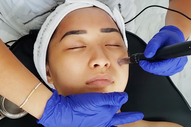 NANO INFUSION | mintsmilebar