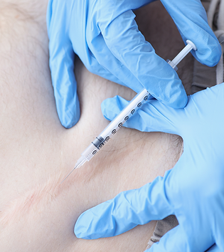 Injection | The Skinbars