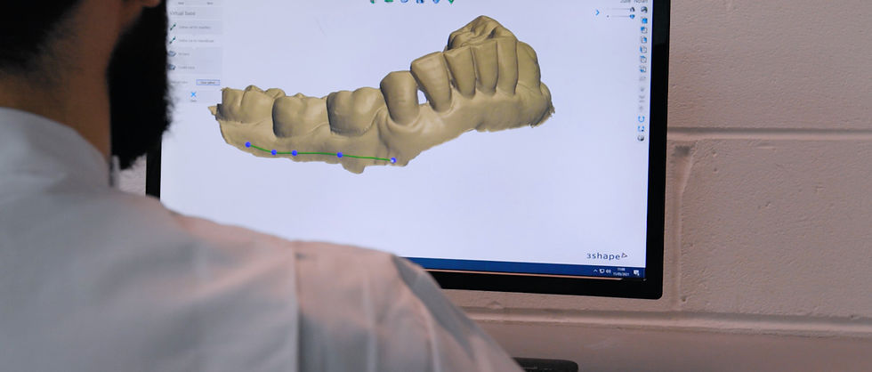 Digital | Bridge Dental Lab | 3D Printing