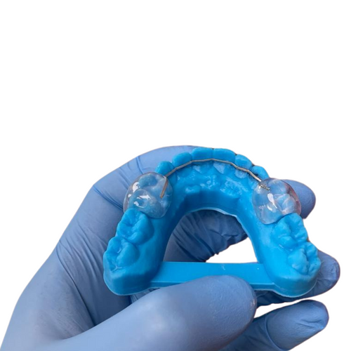 Fixed Retainer With Seating Jig | Bridge Dental Lab