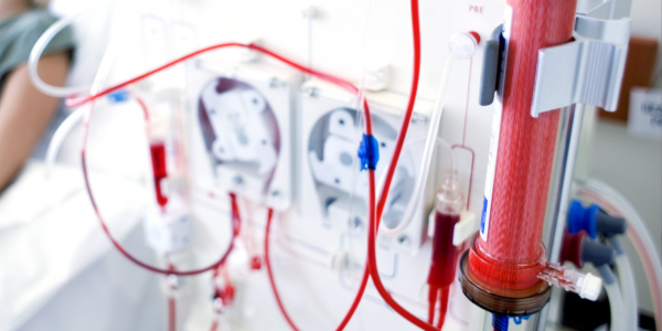 Centre for Nephro and Uro Care | Hycare Hospital