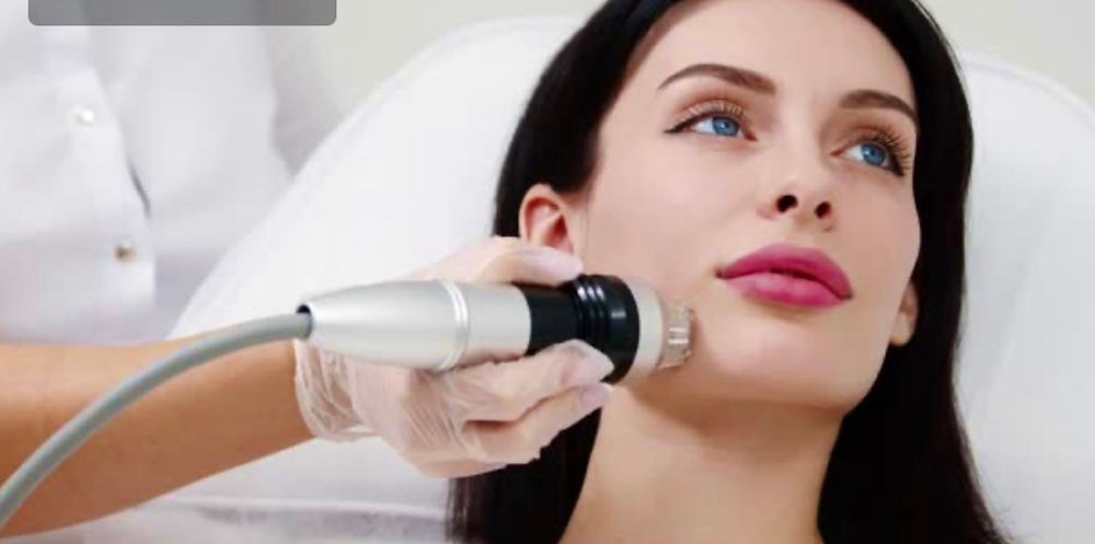 Edith's Esthetics | IPL hair removal | 21800 Towncenter Plaza, Sterling ...