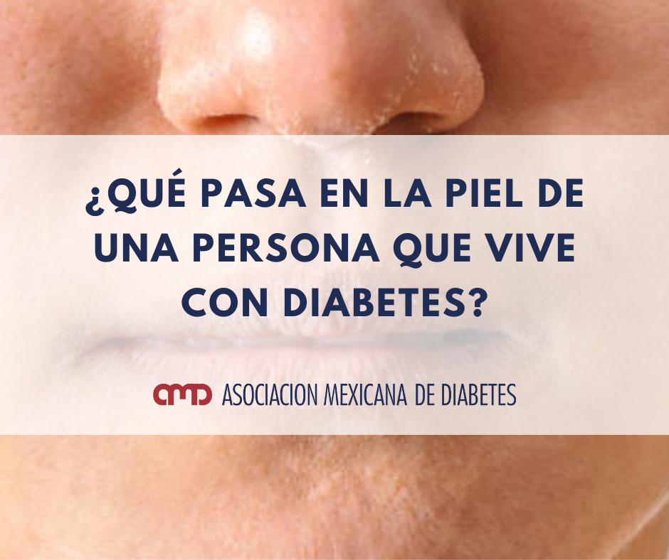 ¿Qué pasa en la piel de una persona que vive con diabetes?