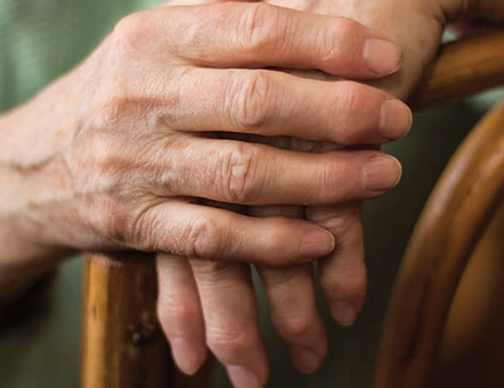 Hand Arthritis: How to Spot the First Signs and Ease Pain