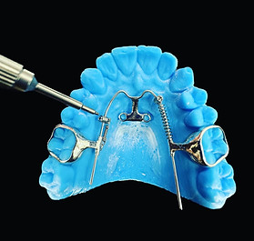 TAD System | Zan Ortho Lab