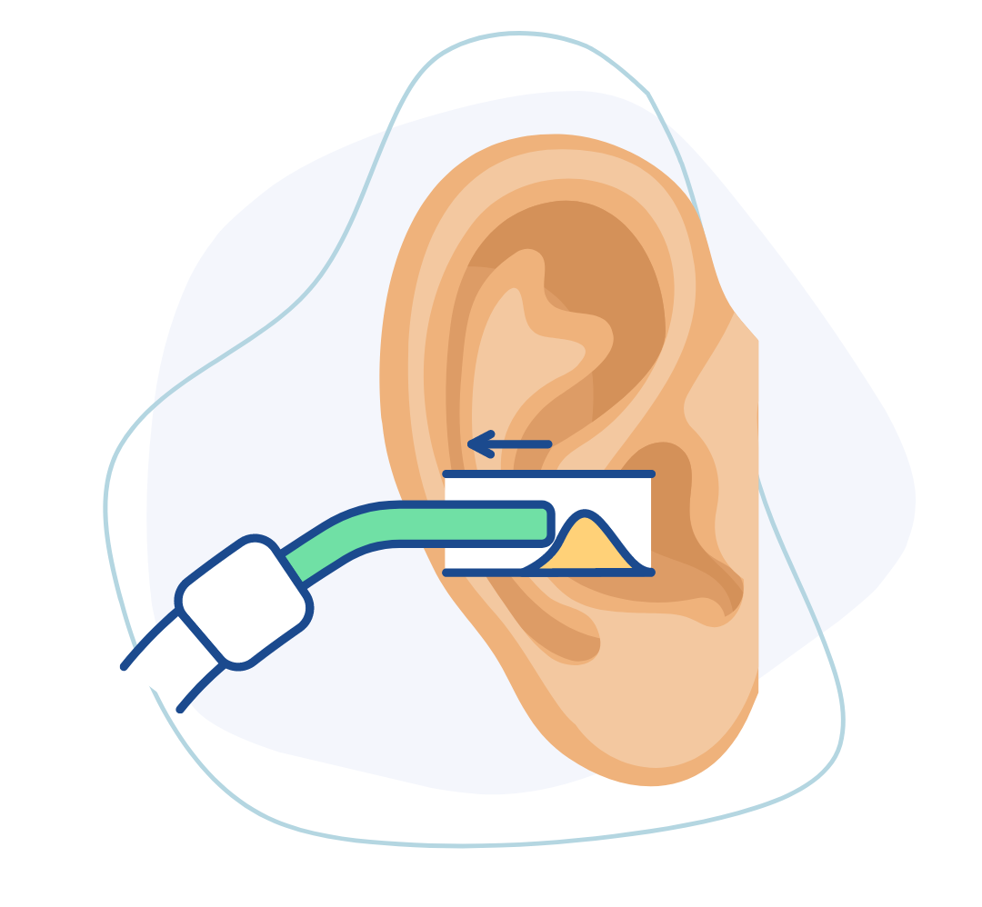 Earwax removal microsuction