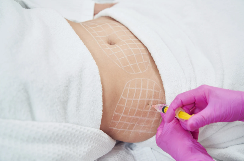 AQUALYX Fat Dissolving Injections | Epicare Health